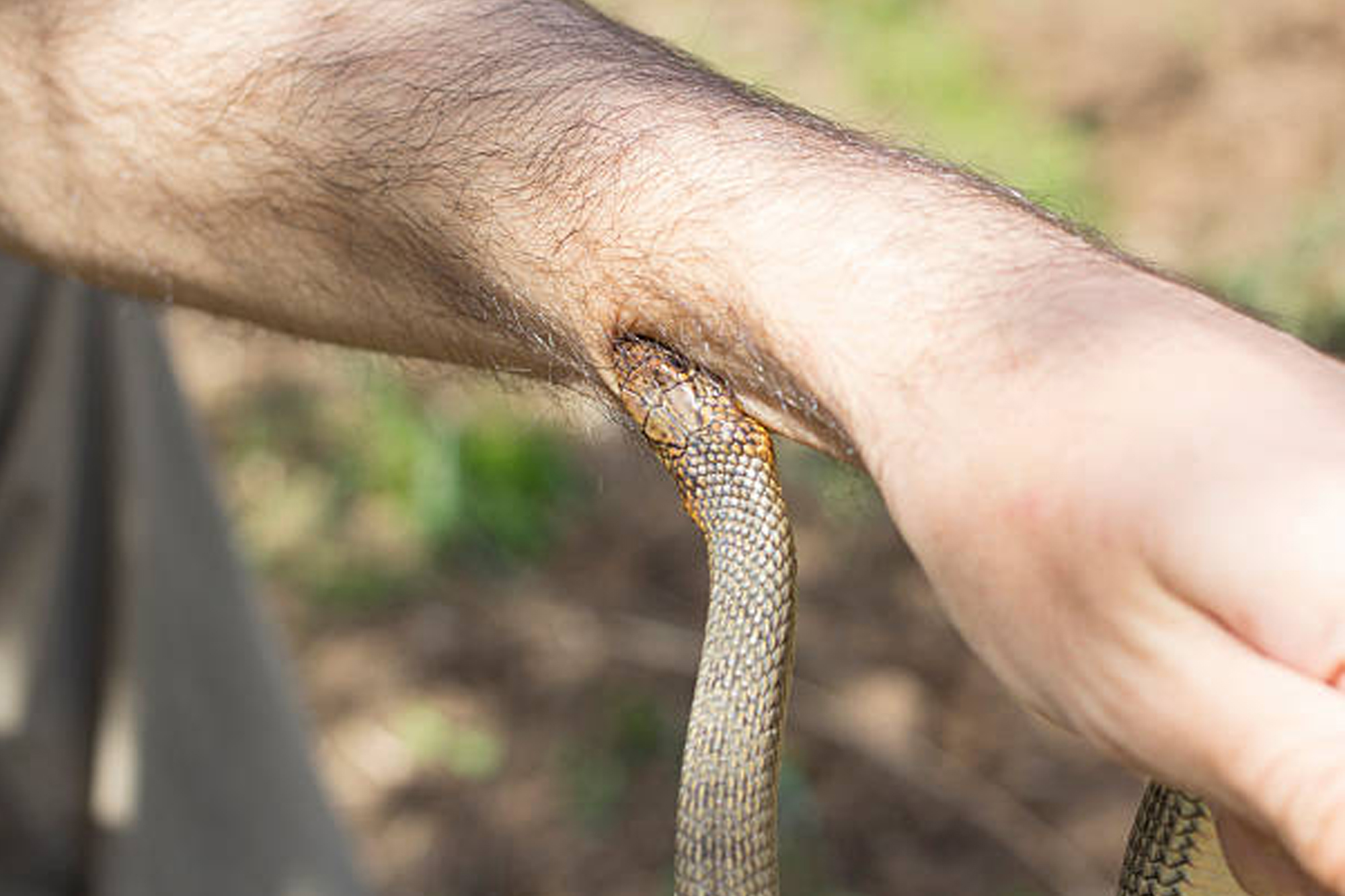 Bushmaster Snake Bite